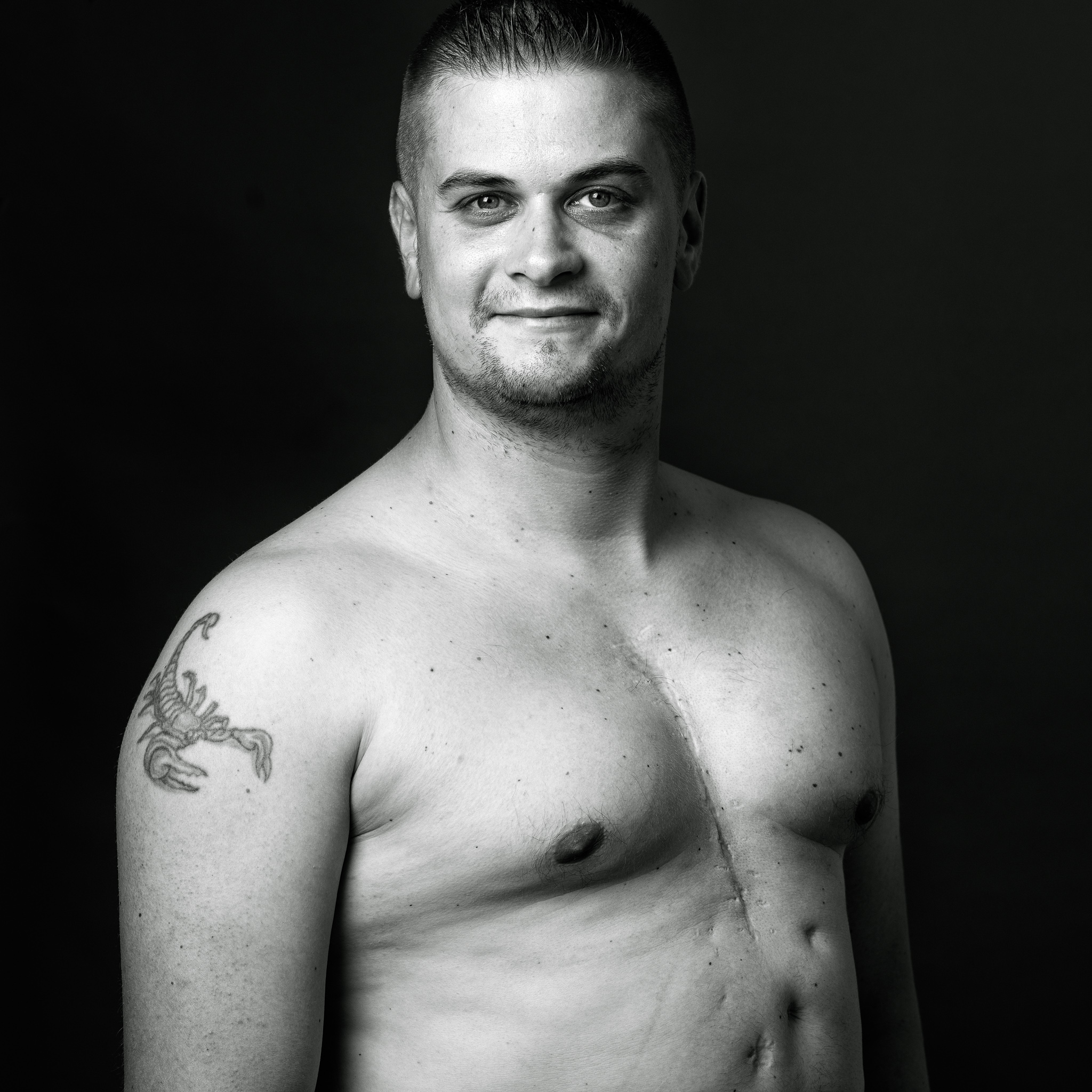 Benjamin – Ma cicatrice